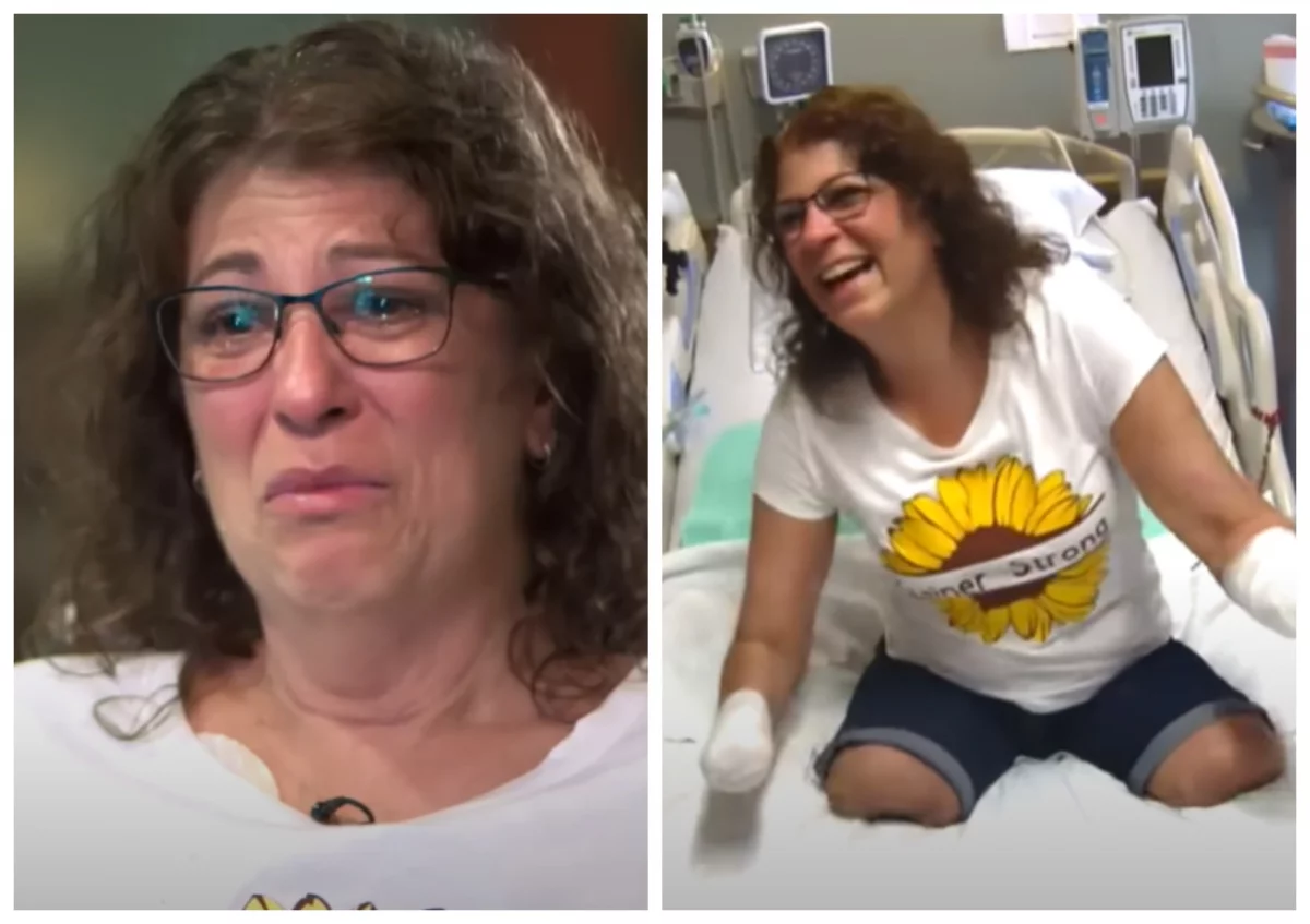 Marie Train miała amputowane kończyny po polizaniu przez psa. 5 lat ...